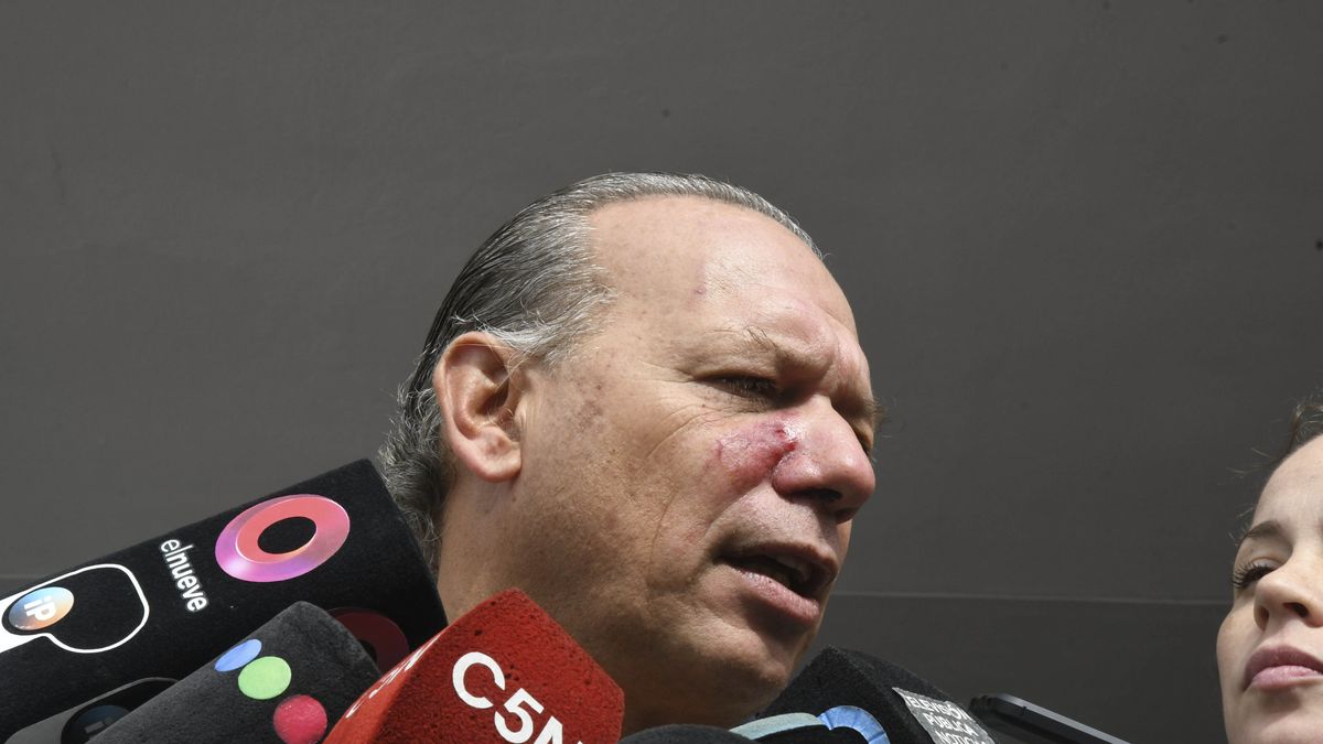 Habló Berni, tras la agresión: Duele más que un bonaerense haya sido ...