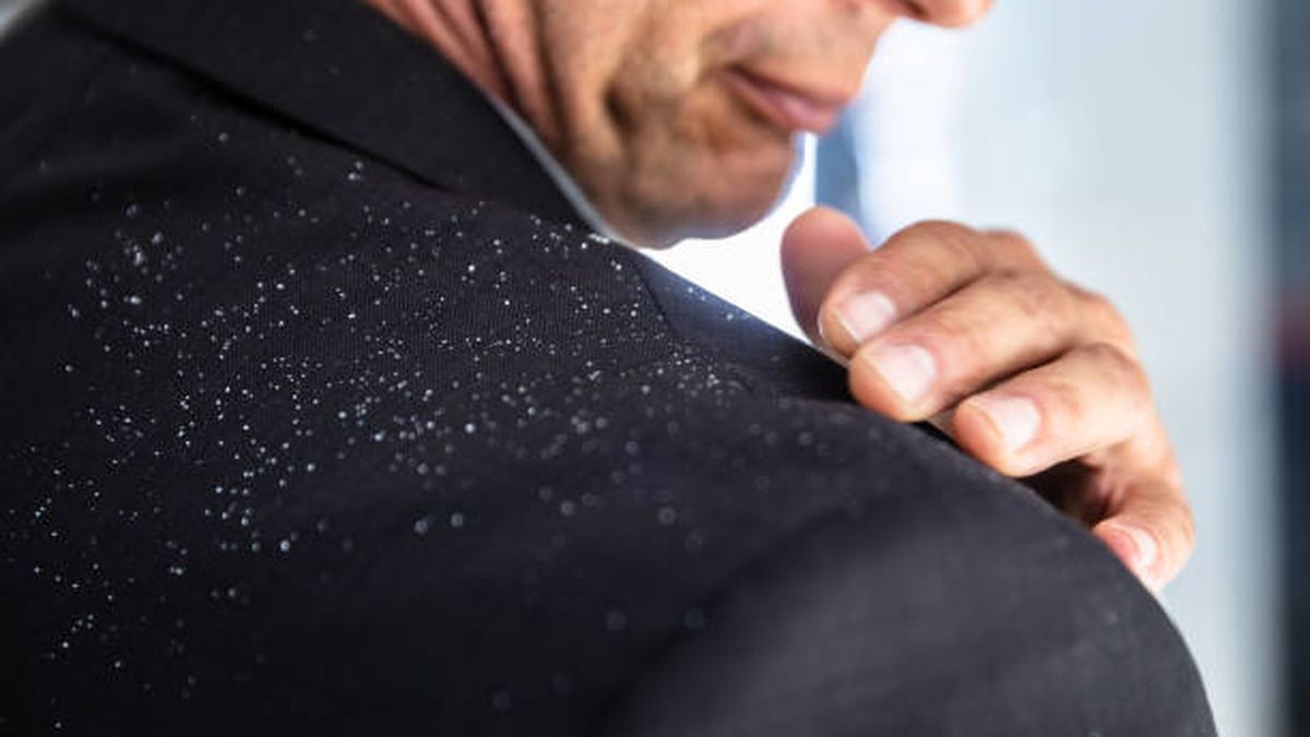 Chau CASPA para siempre: los 5 métodos caseros para eliminar los ...