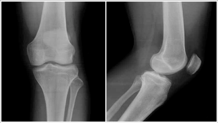 Así quedó la pierna de Luciano Sánchez, el futbolista de Argentinos Juniors