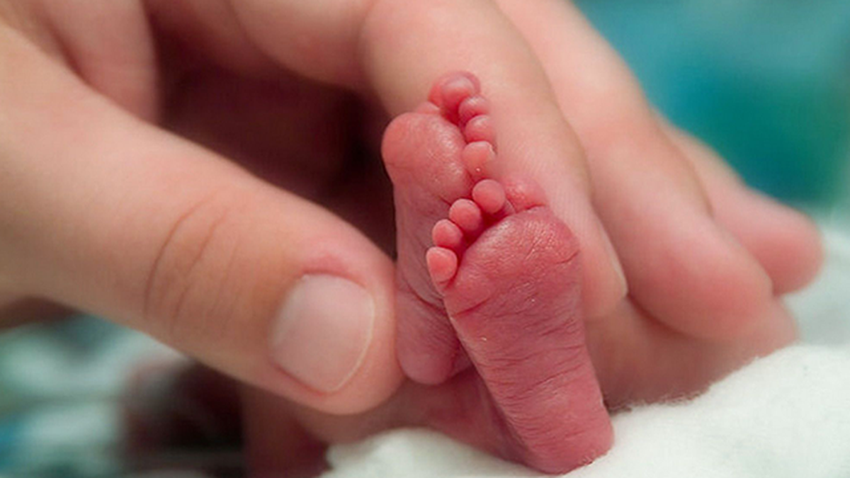 Semana Internacional del Prematuro: qué deben tener en cuenta padres y ...