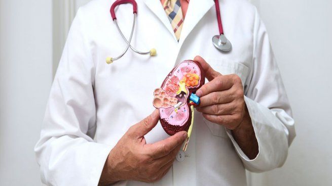 Día Mundial del Riñón: ¿por qué se conmemora cada 9 de marzo?