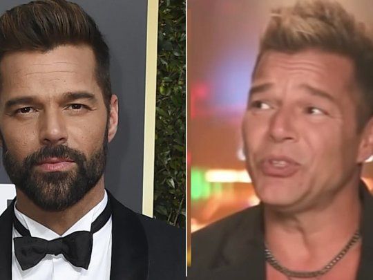 Ricky Martin salió a explicar qué fue lo que pasó con su rostro