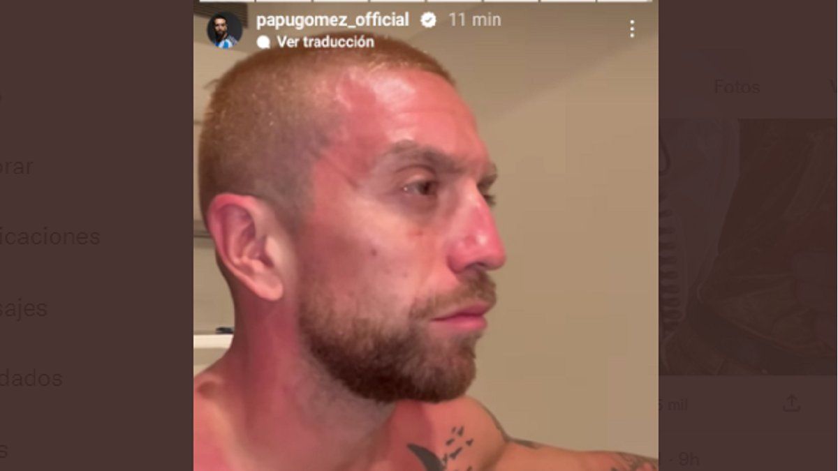El Papu Gómez al rojo vivo: así quedó el jugador argentino después de ...